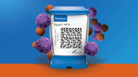 O papel do Xpert® HPV no acesso à prevenção do câncer do colo do útero