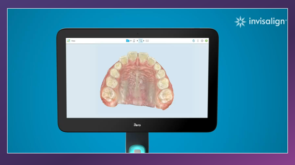 Scanning for Invisalign Palatal Expander System