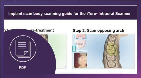 Implant scan body scanning guide