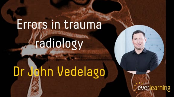 Errors in Trauma Radiology | everlearning Radiology Webinar