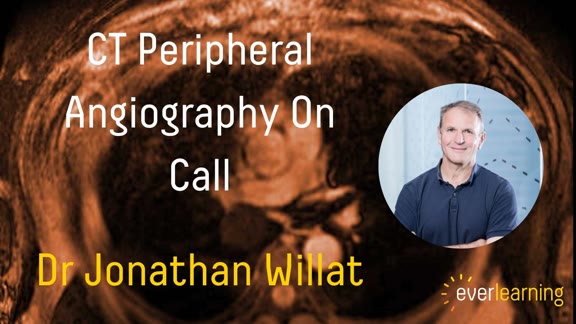 CT Peripheral Angiography On Call | everlearning Radiology Webinar